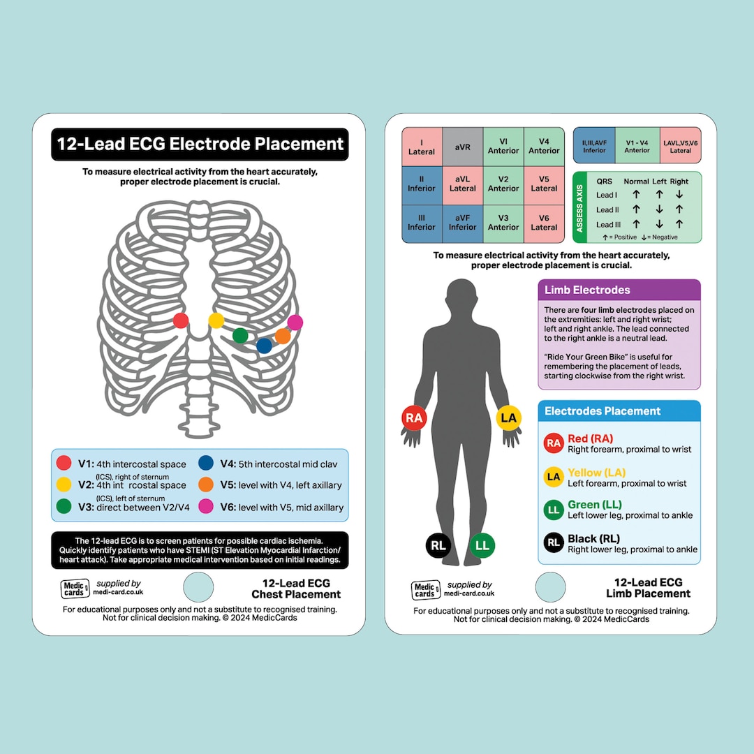 12-lead ECG STEMI & Electrode Placement Pocket Card - Etsy UK