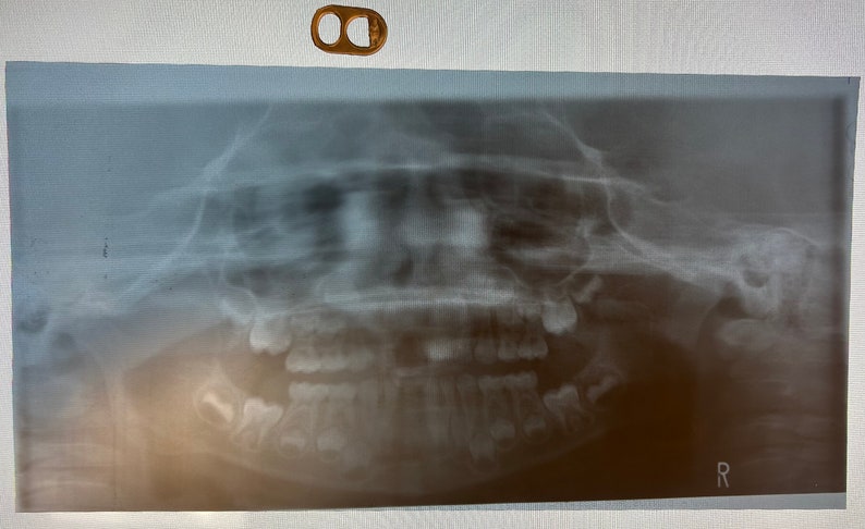 Vintage Dental X-rays - Etsy