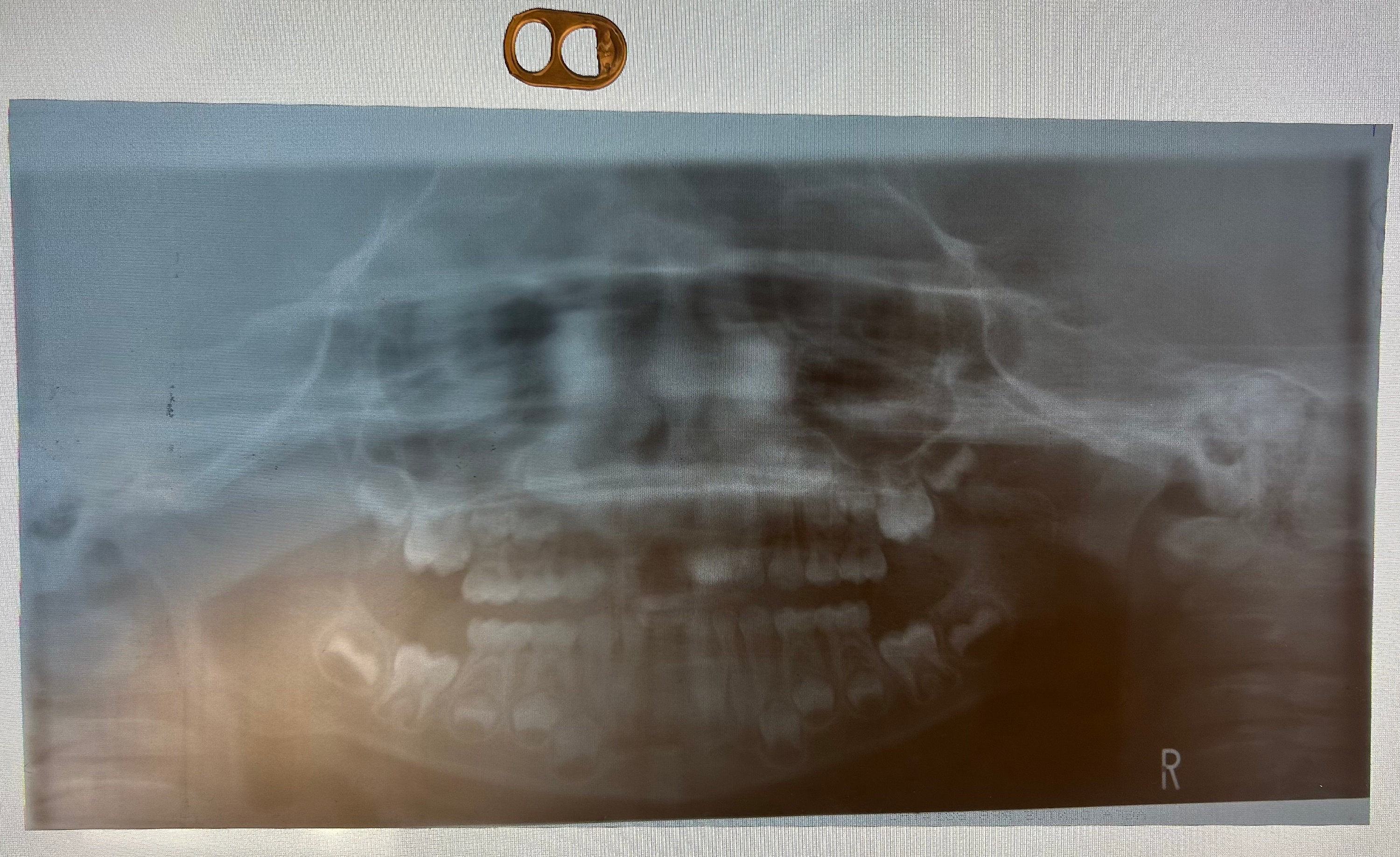 Vintage Dental X-rays - Etsy