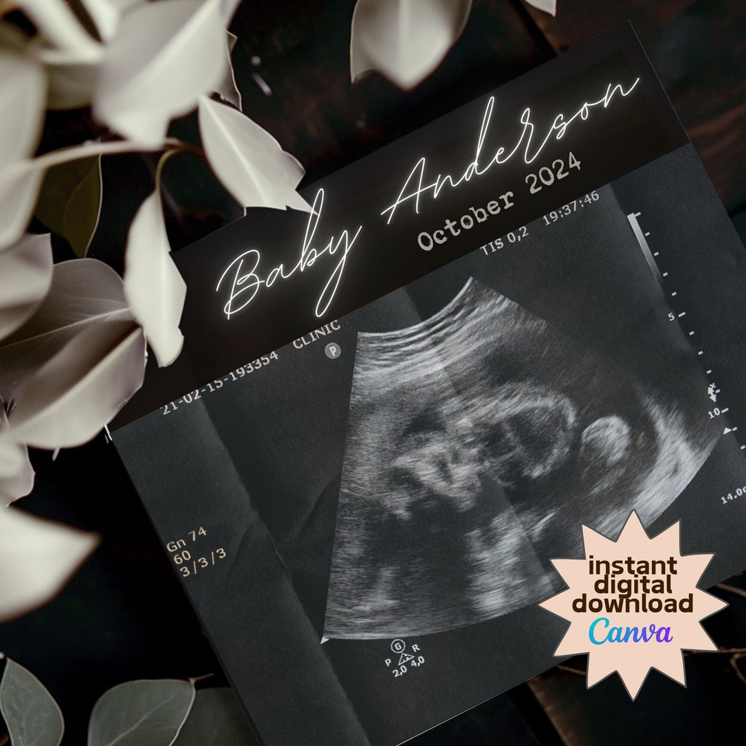 Gender Neutral Pregnancy Announcement Digital, Minimalist Baby ...