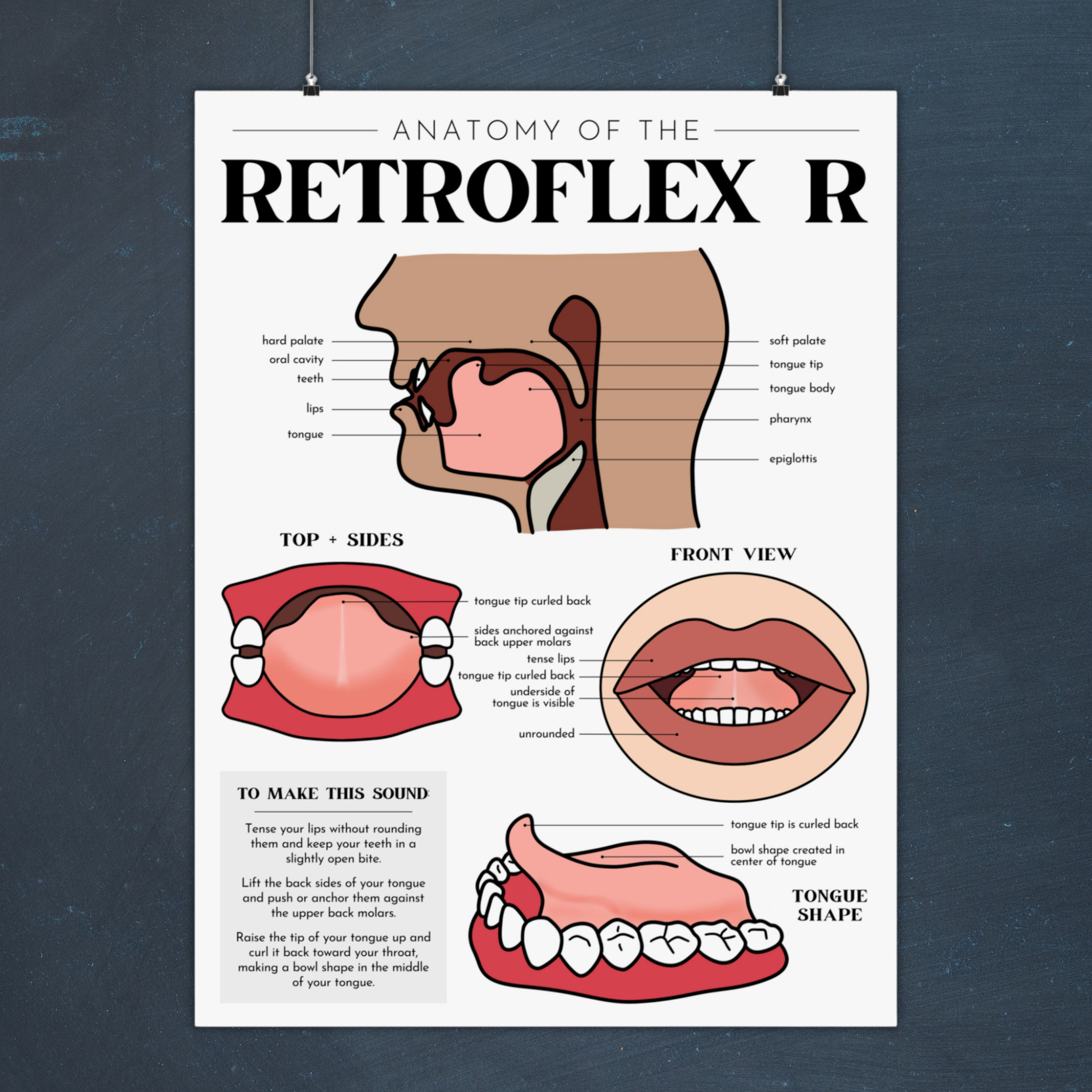 Anatomy of the Retroflex R Speech Sound Poster, Speech Sound Cue Poster ...