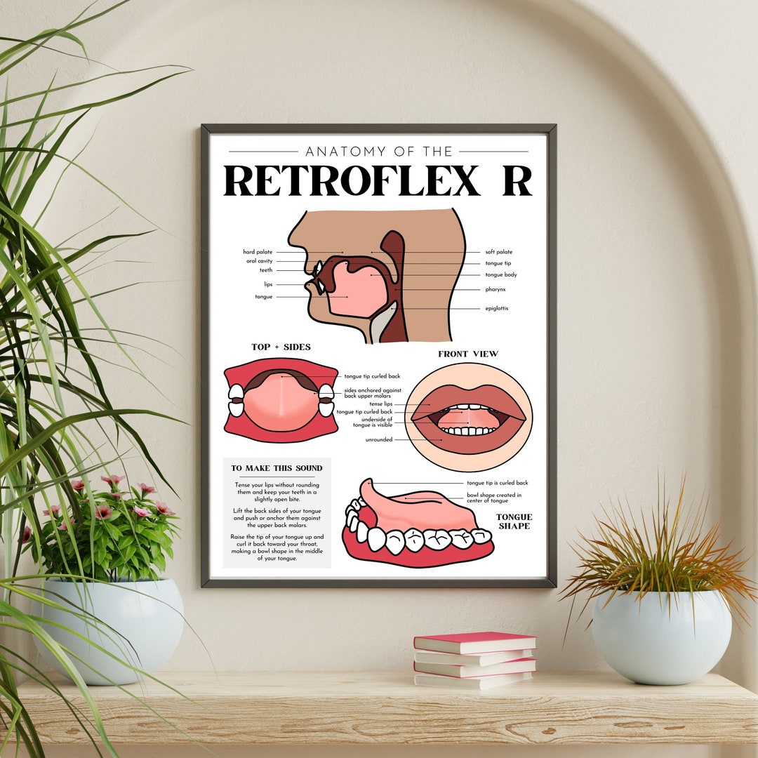 Anatomy of the Retroflex R Speech Sound Poster, Speech Sound Cue Poster, Speech Therapy Poster ...