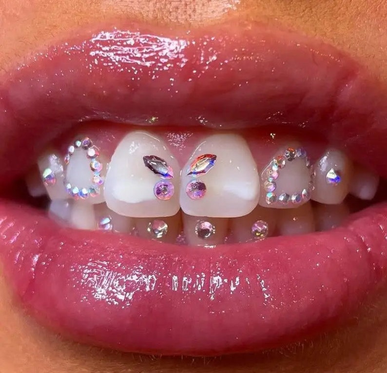 DIY Tooth Gem Starter Kit: Professional Dental Glue, Rhinestones - Etsy