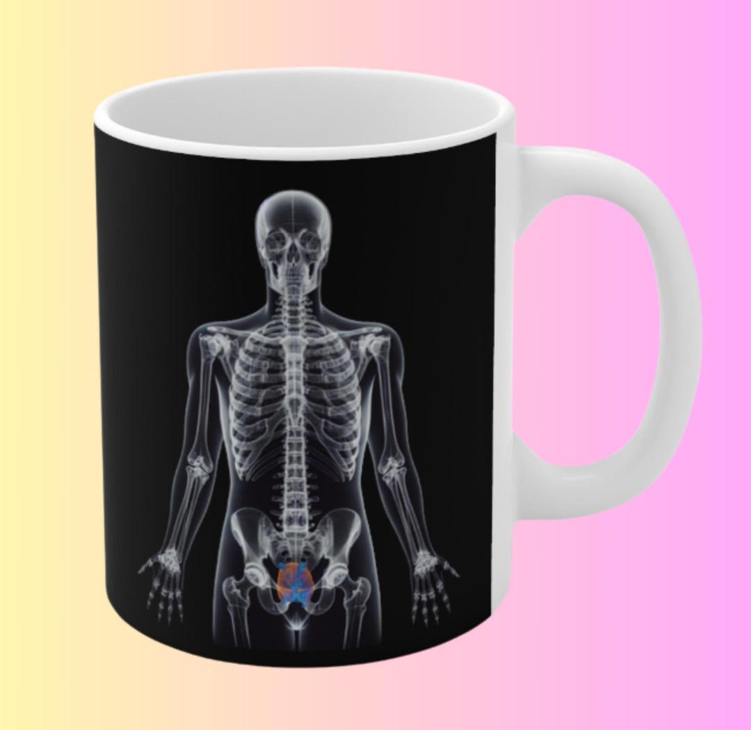 Adult X-ray Skeleton Mug, Rude Anatomical Coffee Cup, Medical Students ...