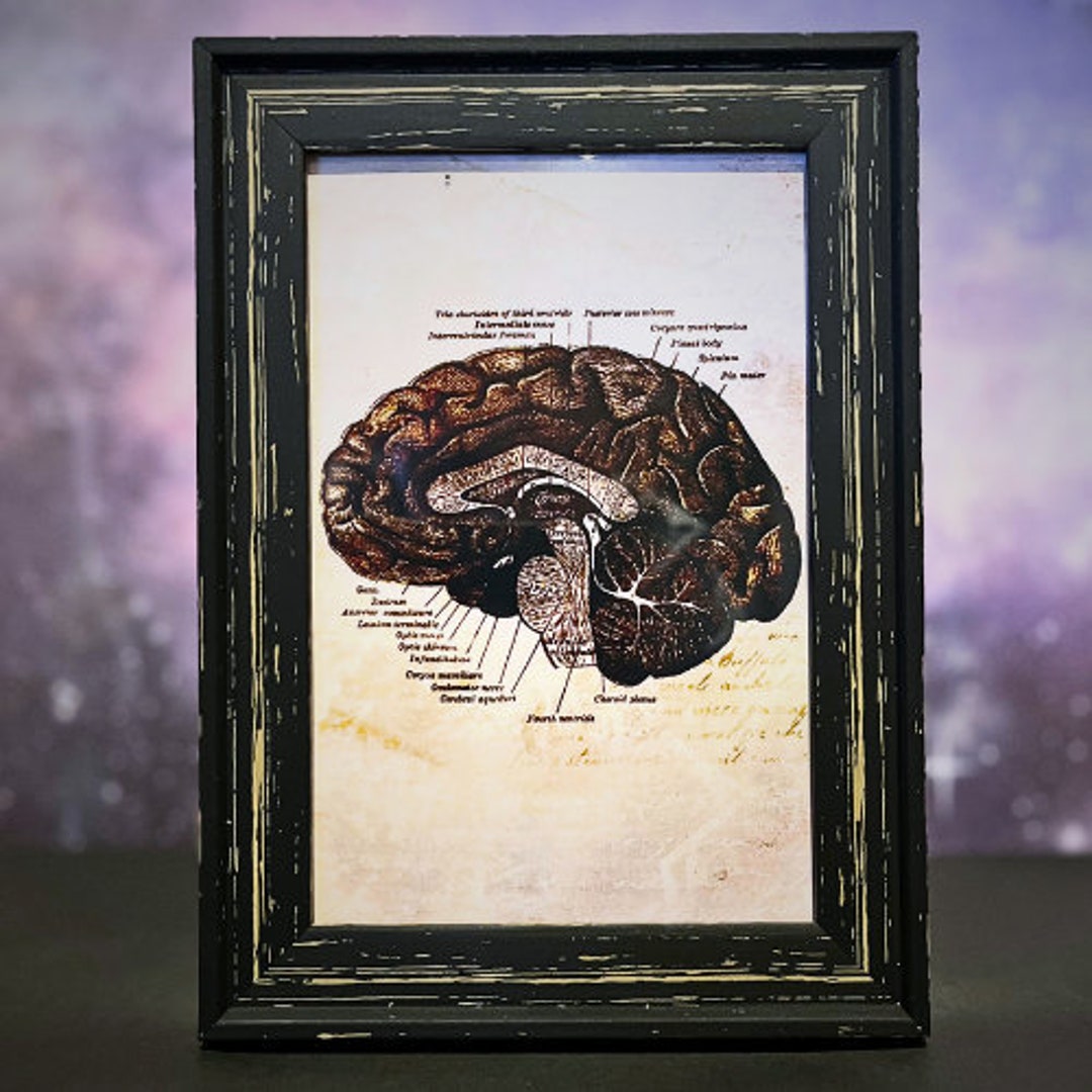 Greys Anatomy Detailed Brain Frame Detailed Medical Diagram. Autopsy ...