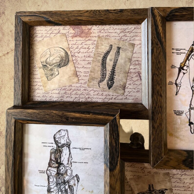 Antique Skeletal System Collage Frame Medical Diagram. Autopsy, Surgery ...
