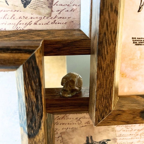 Antique Skeletal System Collage Frame Medical Diagram. Autopsy, Surgery ...