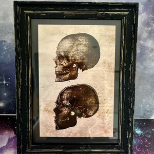 Greys Anatomy Double Skull Frame Medical Diagram. Autopsy, Surgery ...