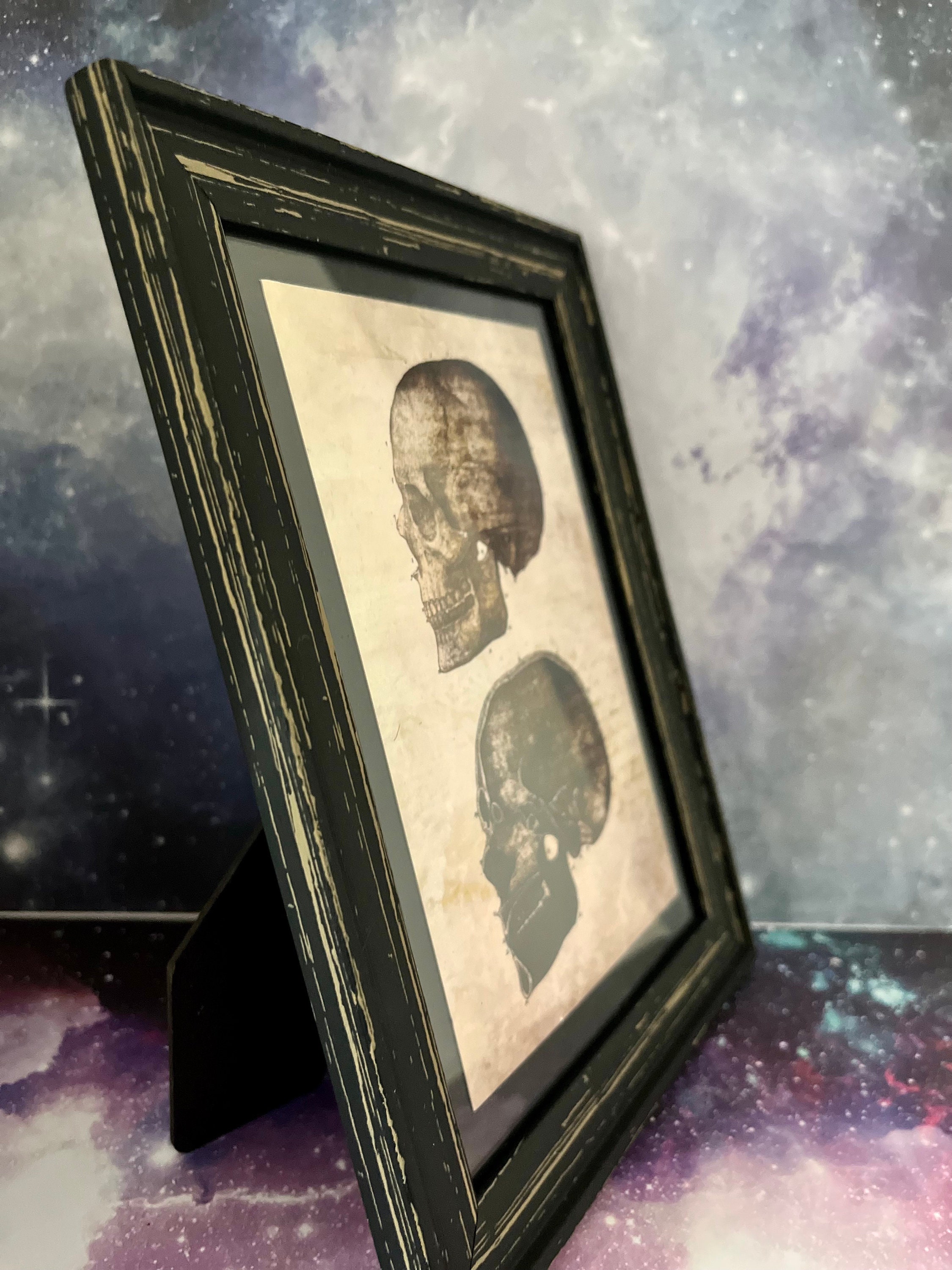 Greys Anatomy Double Skull Frame Medical Diagram. Autopsy, Surgery ...