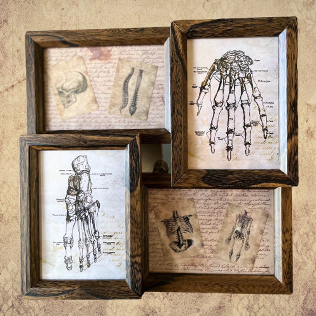 Antique Skeletal System Collage Frame Medical Diagram. Autopsy, Surgery ...