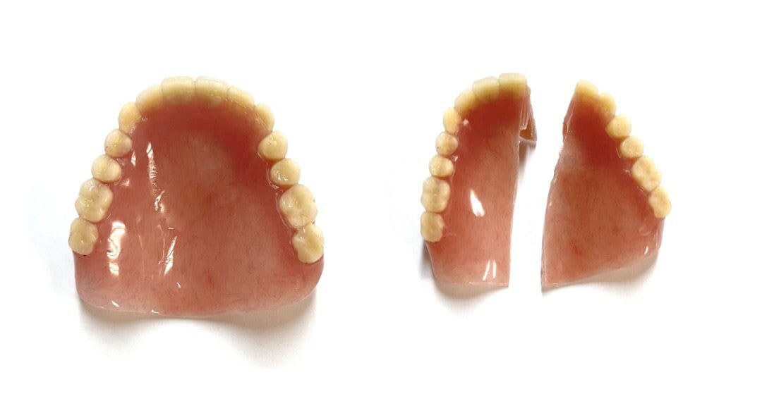 Denture/partial Repair Fracture/missing Teeth Professional Repair ...