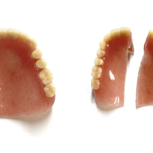 Partial Dentures - Etsy