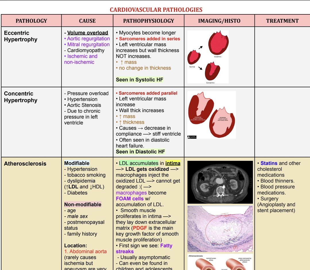 High-yield Cardiology Pathology Chart for Med Students | Step 1 & Step ...