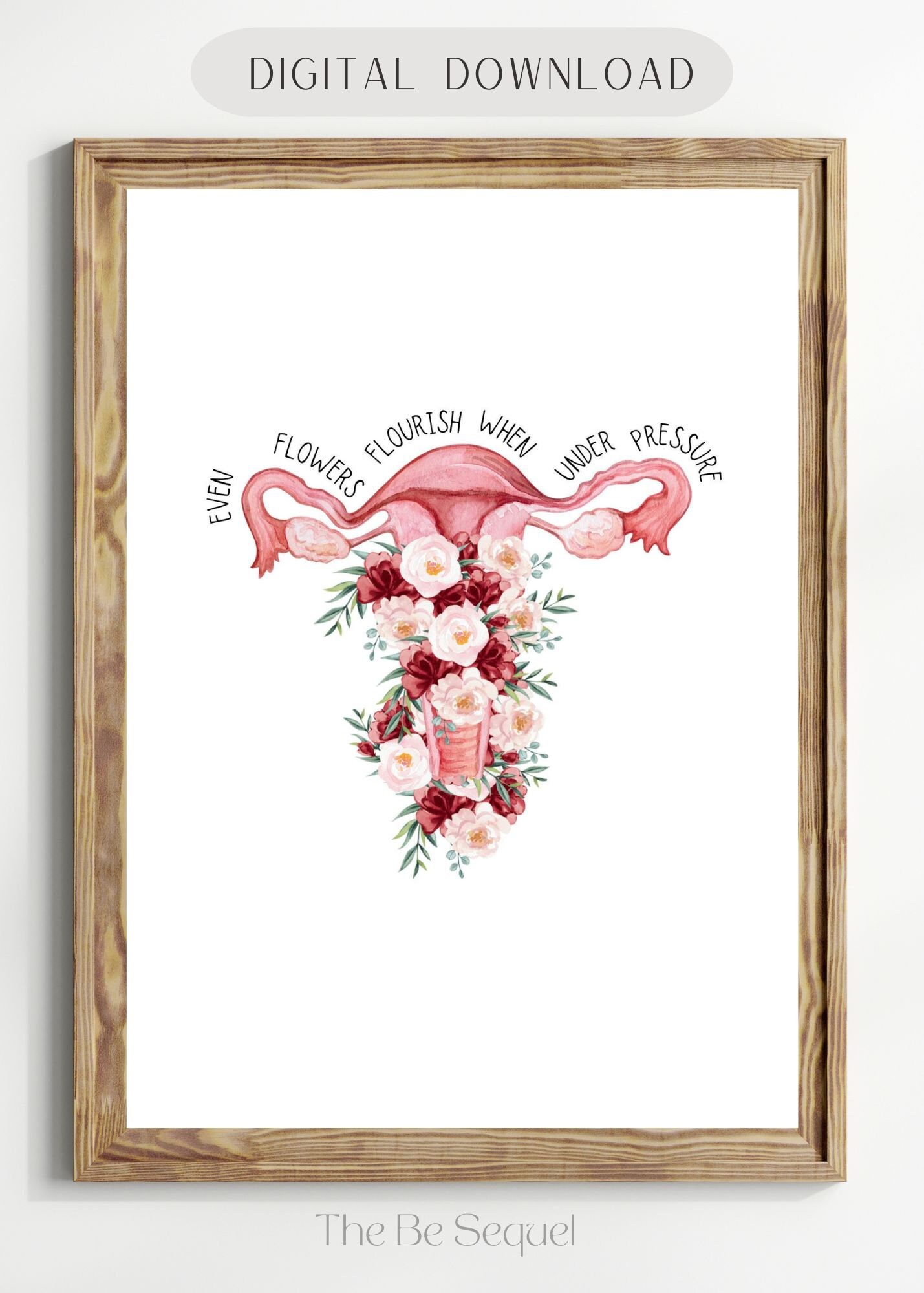 Infertility Wall Art, PCOS, Endometriosis, Fertility Support, Trying to ...