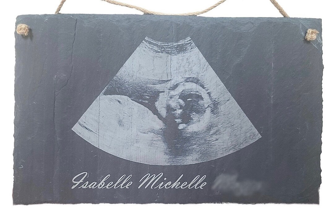 Personalized Ultrasound Sign - Etsy