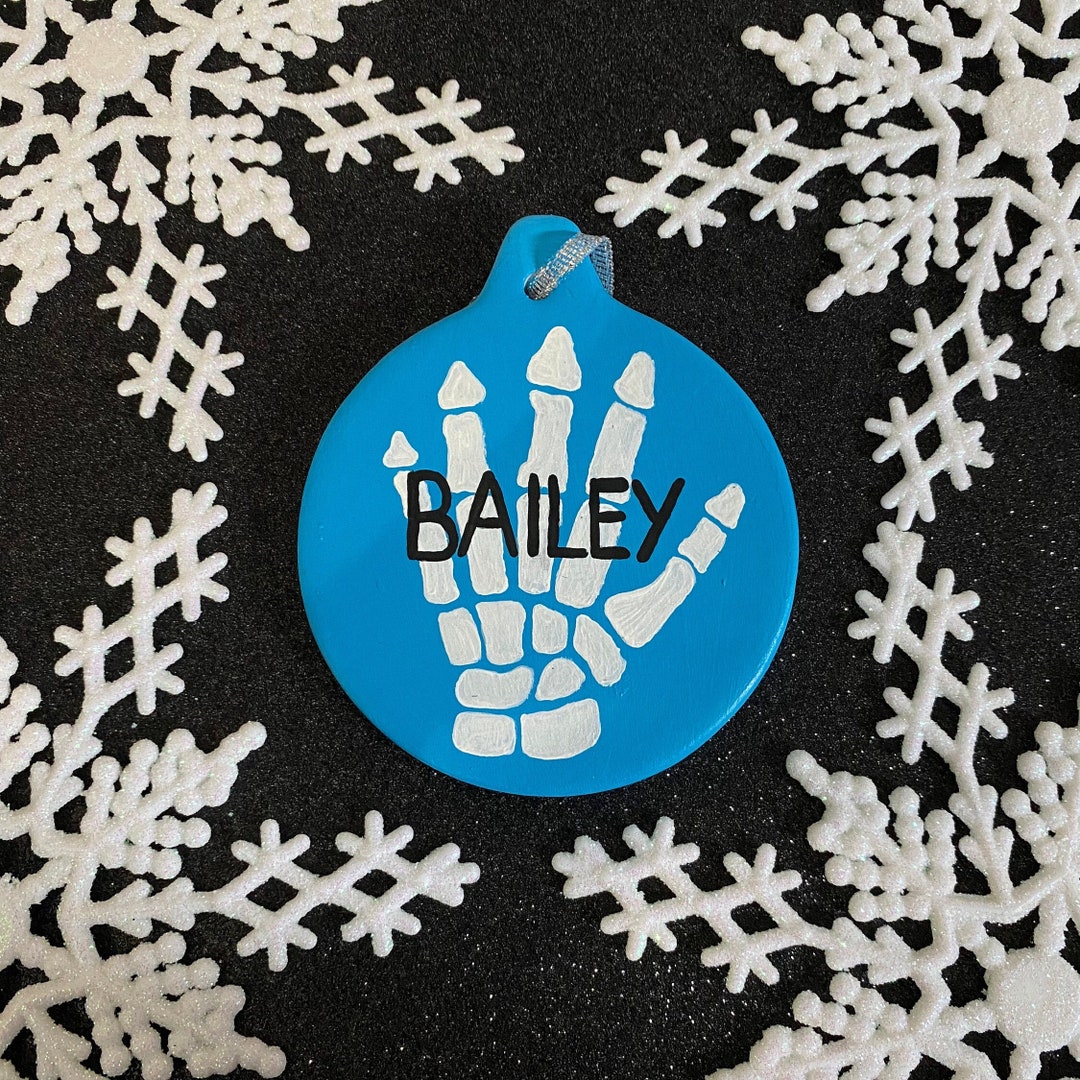 Skeleton Hand Ornament- Crime Scene- Crime Scene Ornament- Crime Scene ...