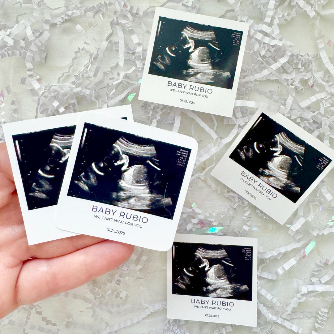 Ultrasound Confetti, Ultrasound Photo, Baby Shower Favors, Gender ...