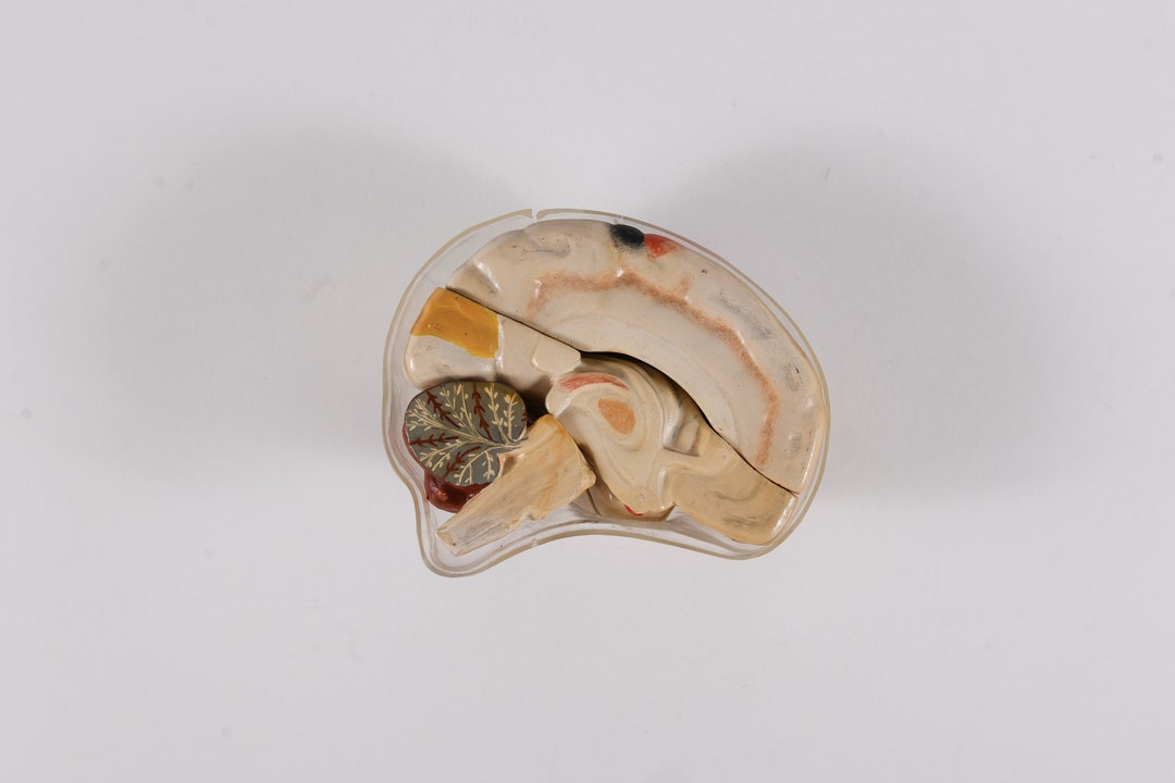 Vintage Anatomical Model Brain Hemisphere Mid-century - Etsy