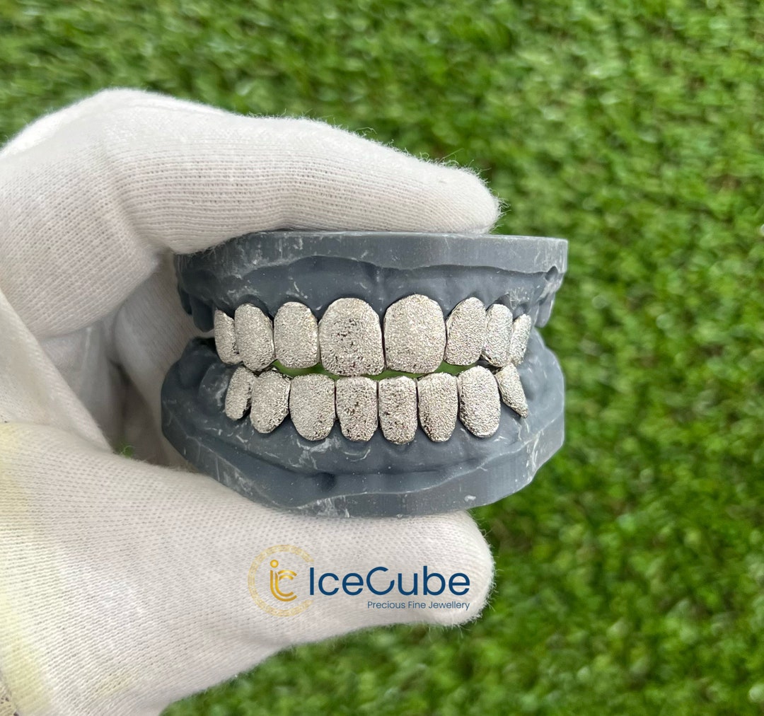 Custom Made Real GOLD and Real SILVER GRILLZ, - Etsy