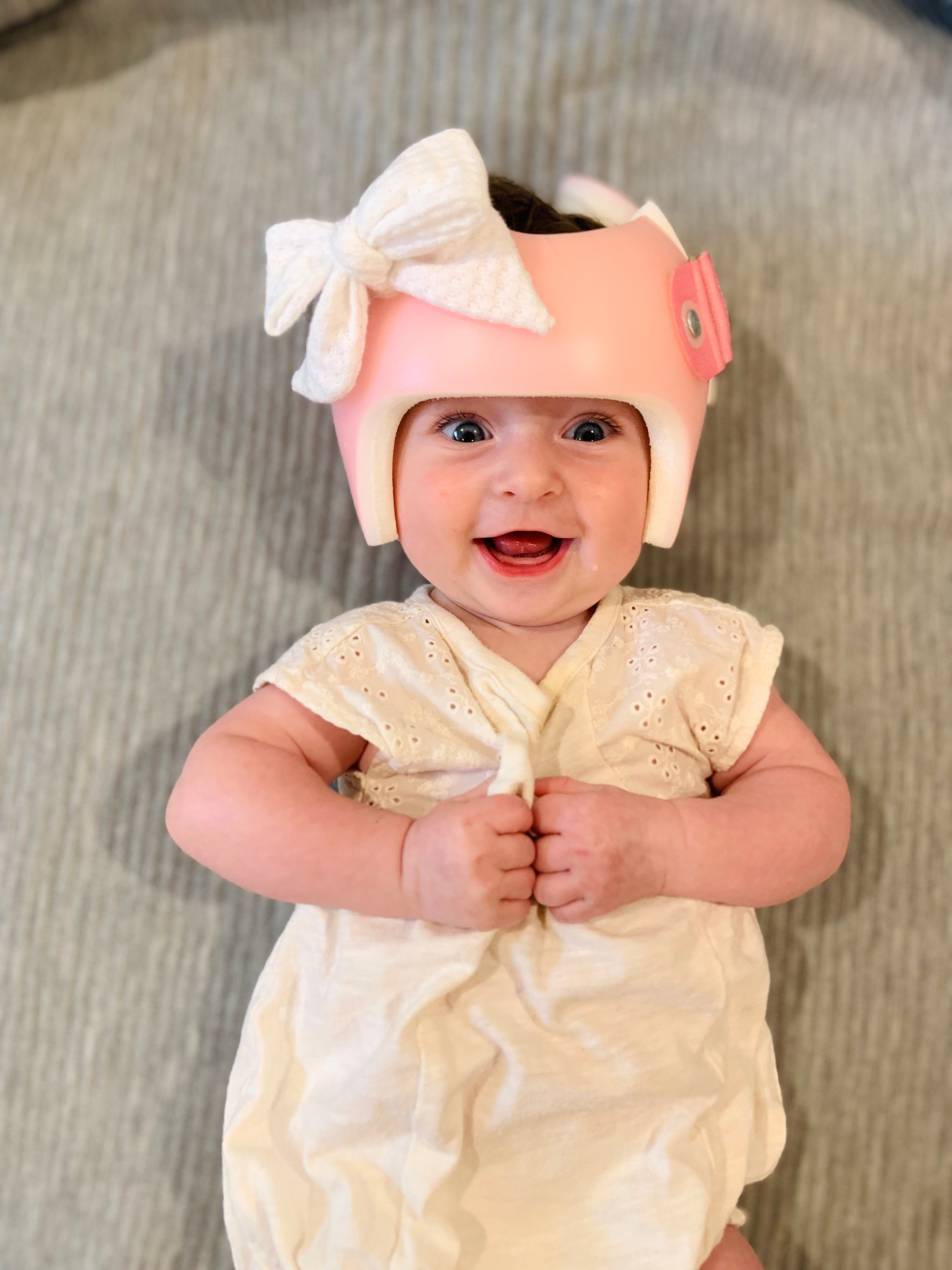 Cranial Helmet Bow DOC Band Bow Starband Bow - Etsy