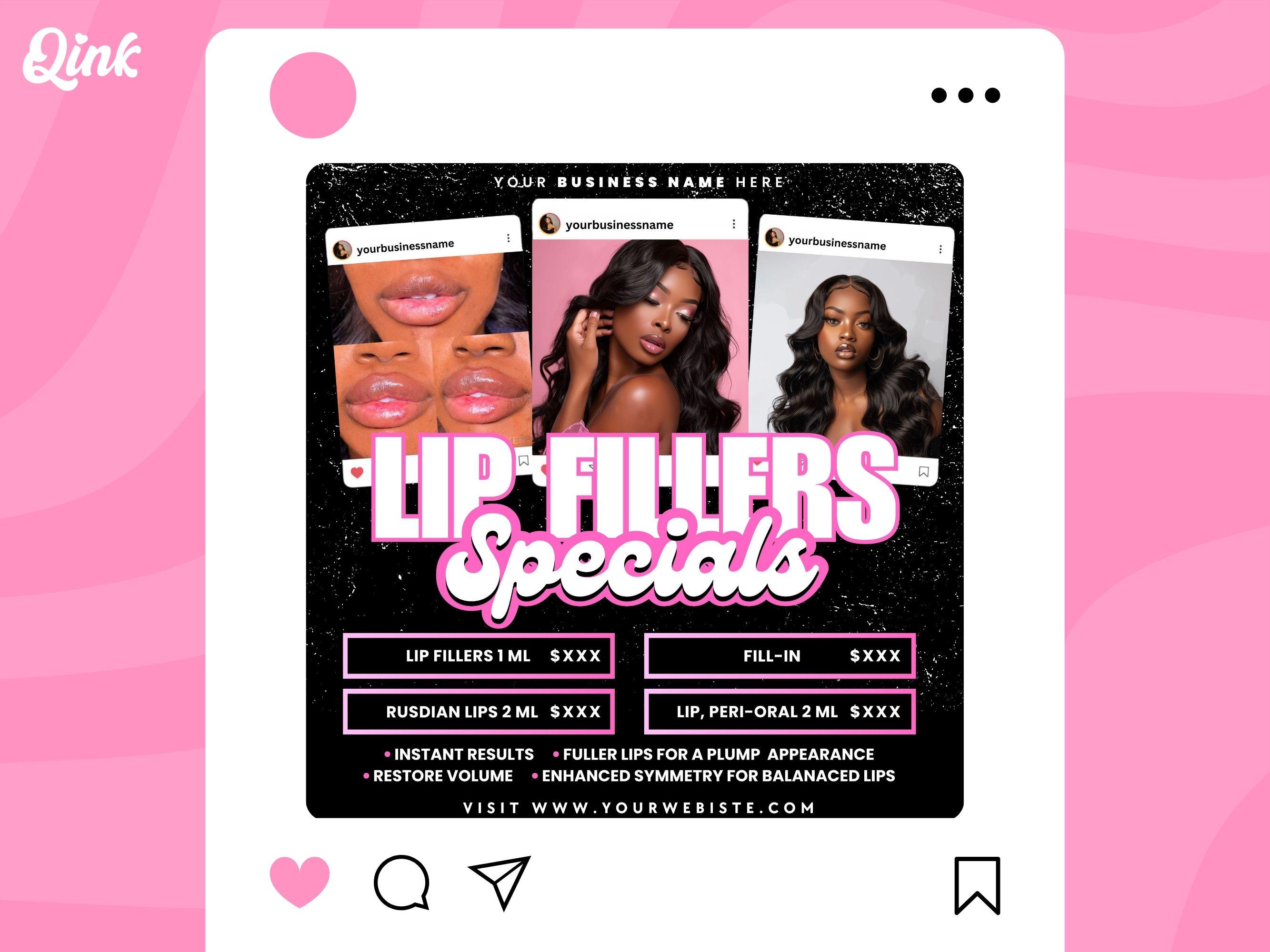 Hyaluron Pen Flyer, Lip Filler Specials Flyer, Dermal Filler Flyer ...