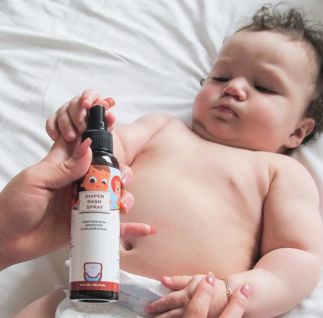 Diaper Rash Spray - Etsy