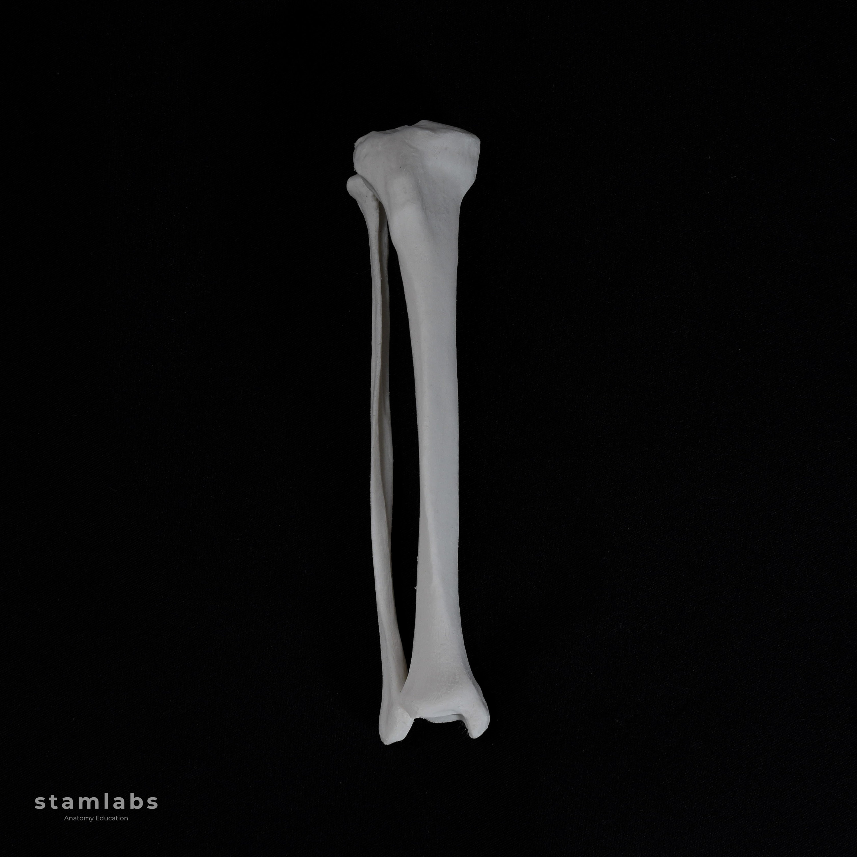 Premium 3D Printed Tibia and Fibula Anatomical Model - Detailed Bone ...