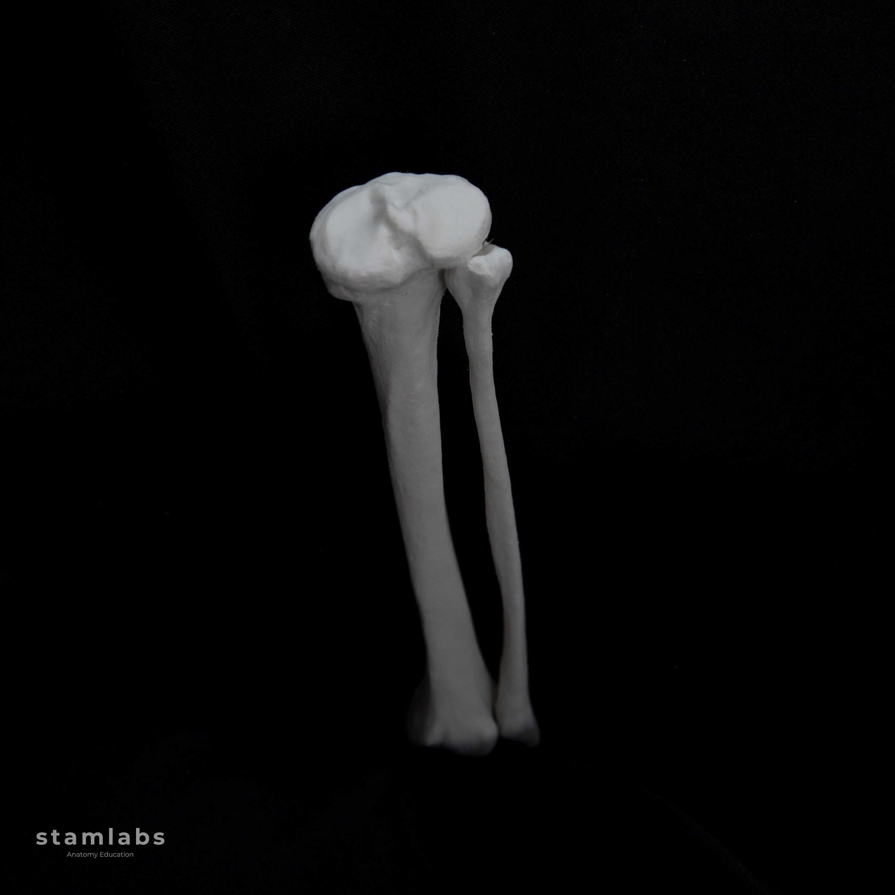 Premium 3D Printed Tibia and Fibula Anatomical Model - Detailed Bone ...