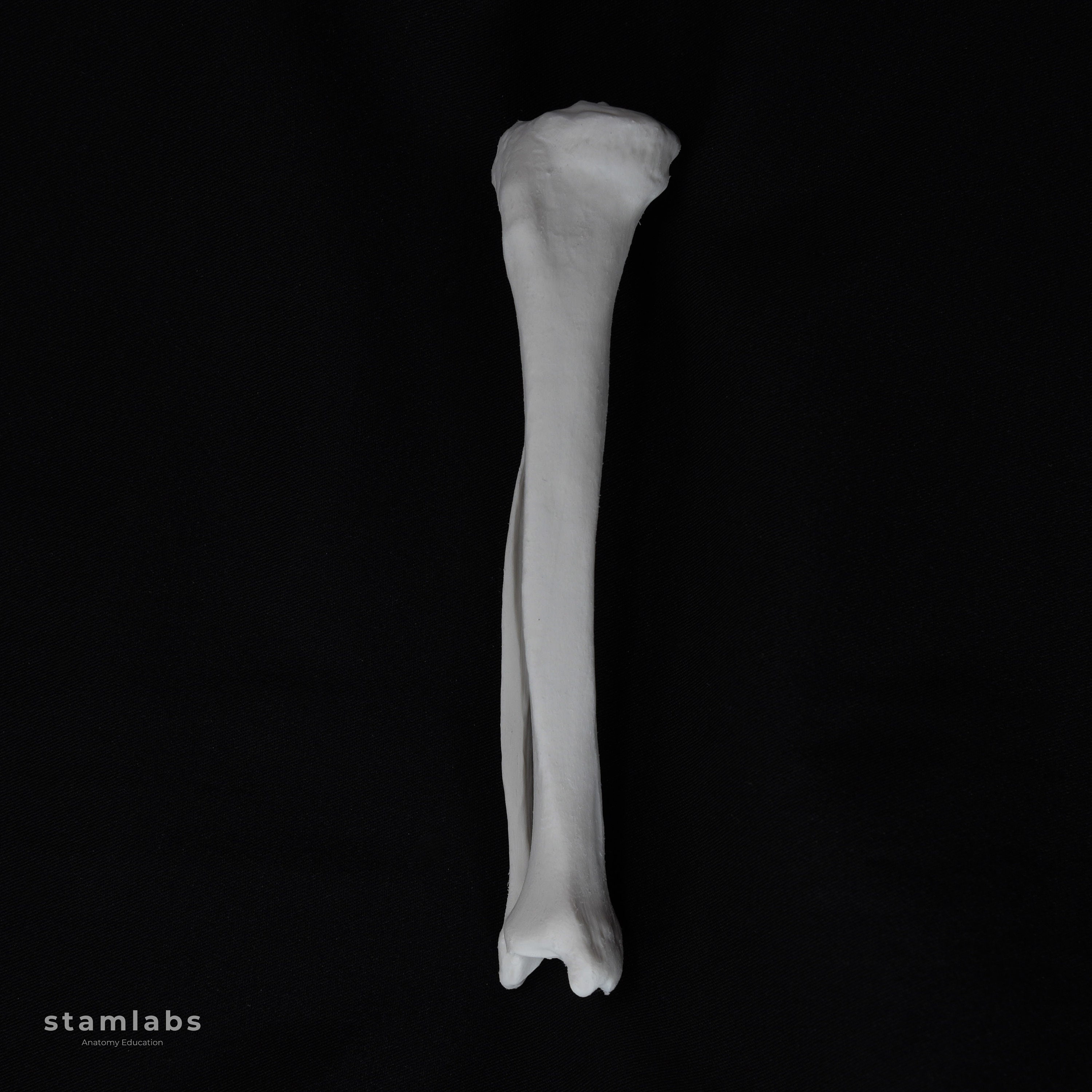 Premium 3D Printed Tibia and Fibula Anatomical Model - Detailed Bone ...