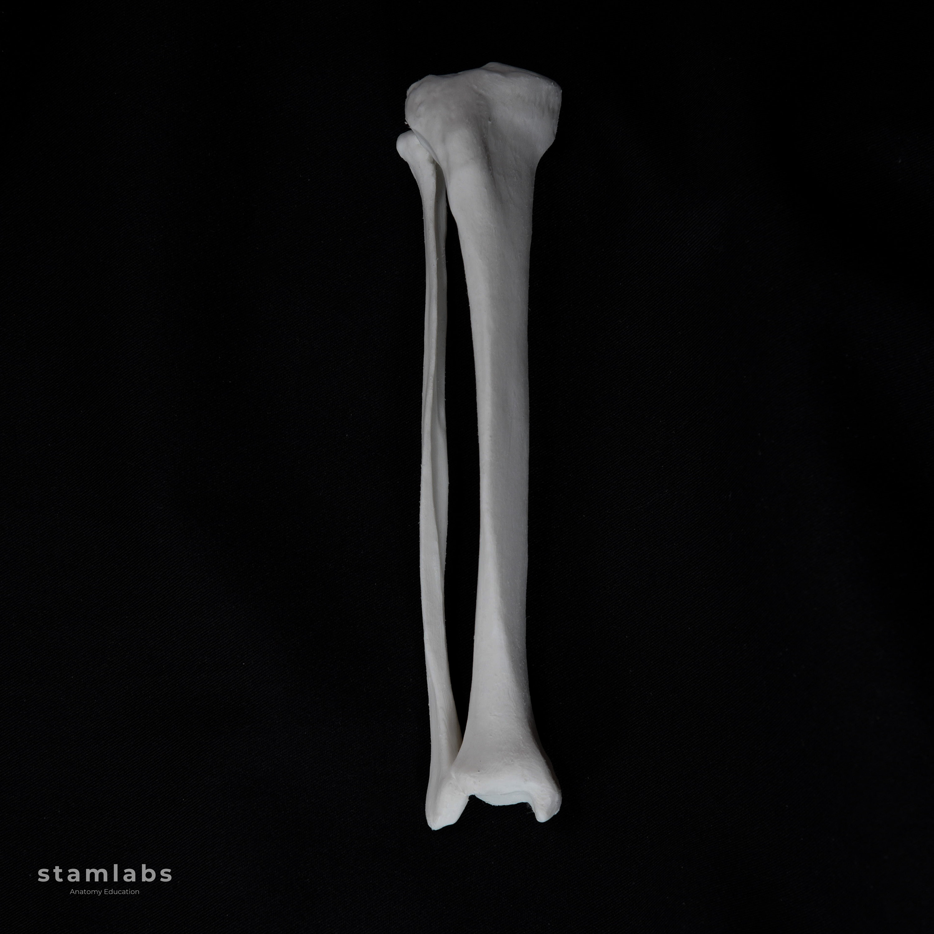 Premium 3D Printed Tibia and Fibula Anatomical Model - Detailed Bone ...