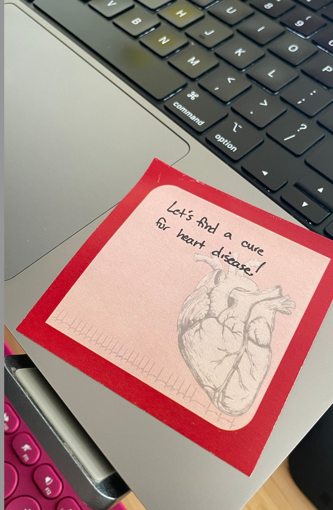 Arrhythmic ECG With Anatomical Heart Sticky Notes - Etsy