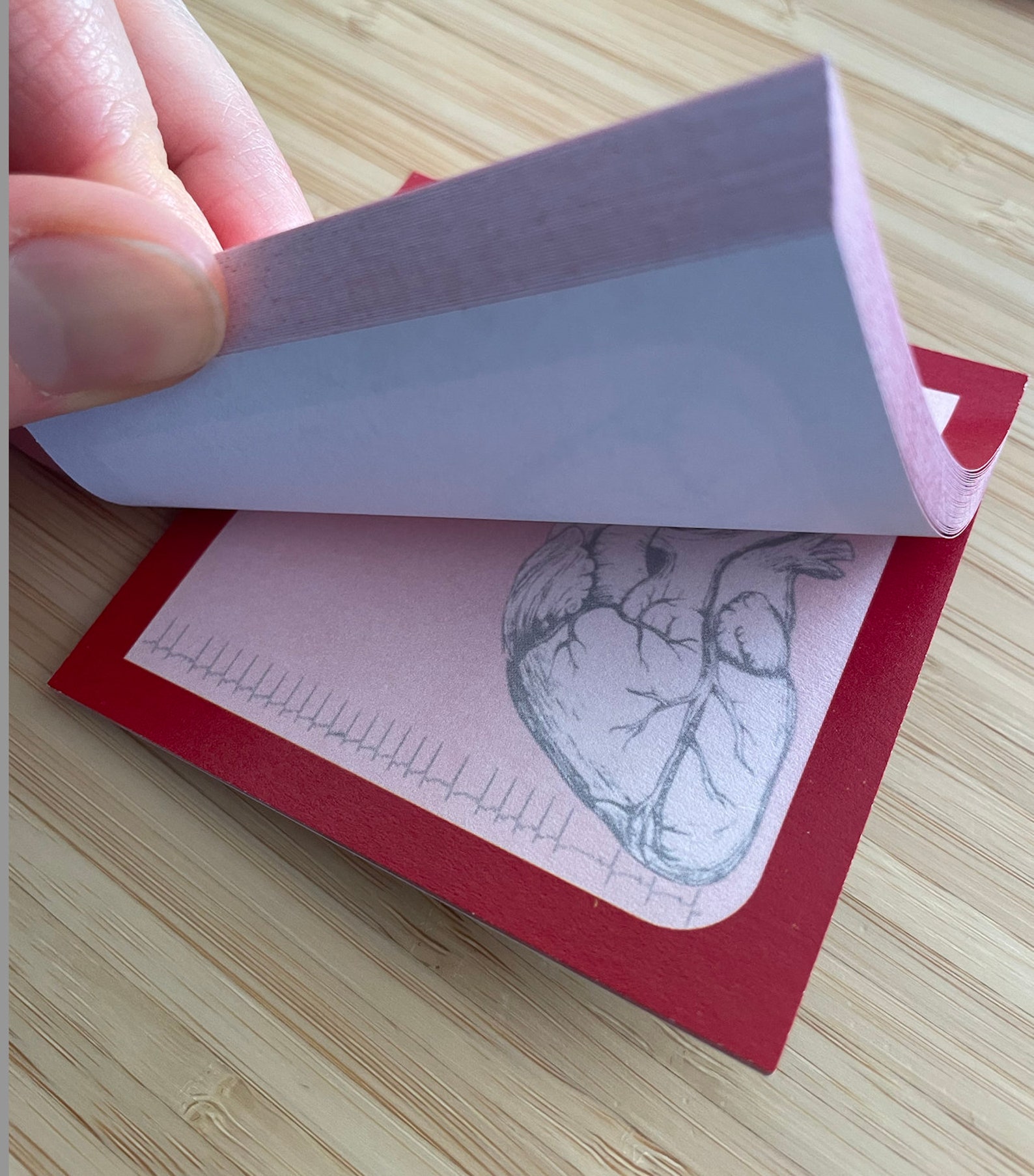 Arrhythmic ECG With Anatomical Heart Sticky Notes - Etsy