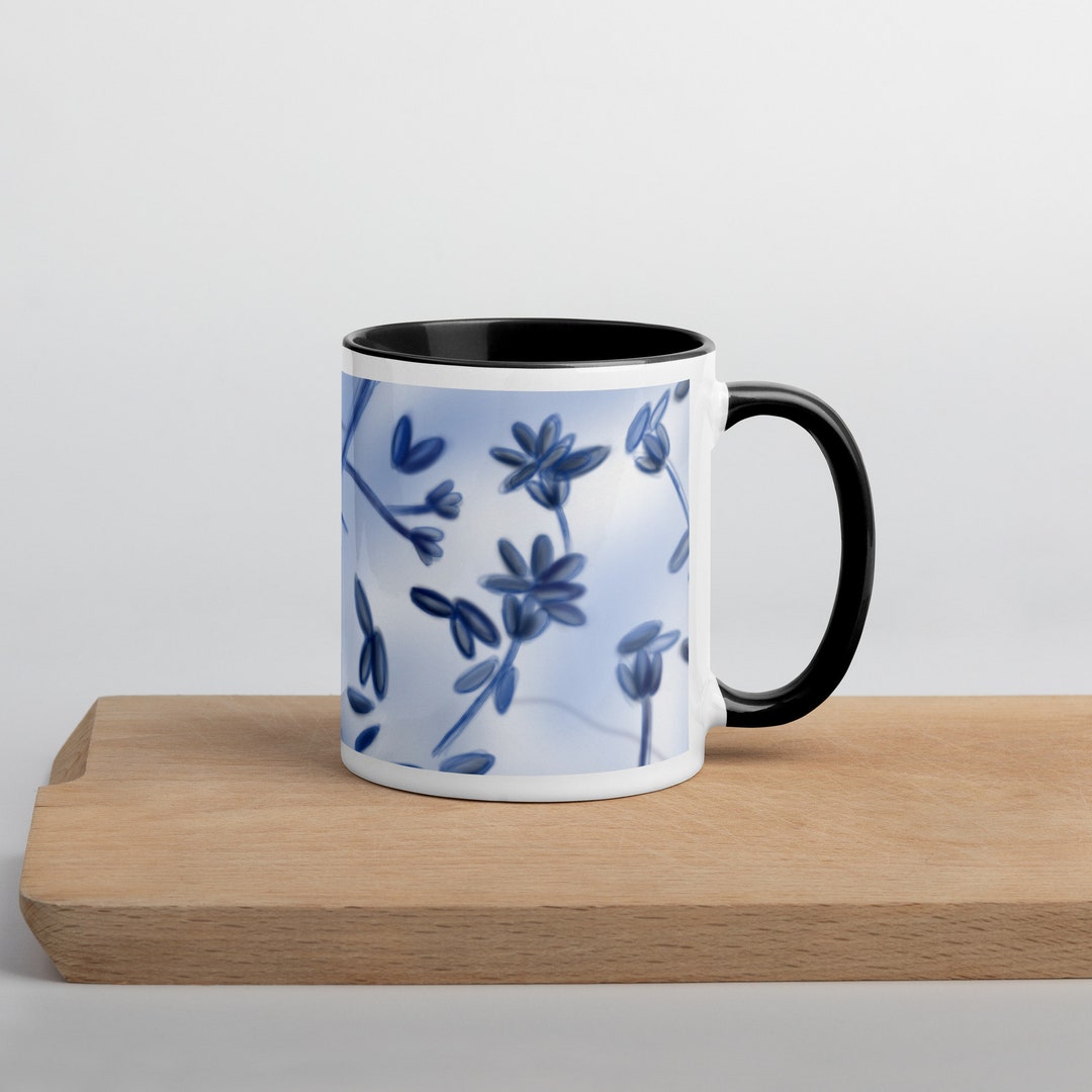 Stachybotrys Species Lactophenol Blue Scotch Tape Prep Mold Mycology ...