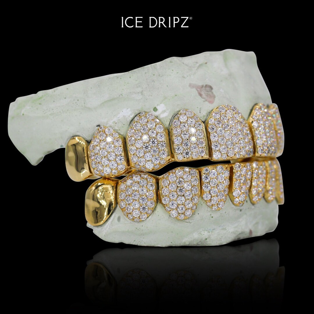 10 on 10 Capped Vvs Moissanite Diamond Grillz, Perm Cut Custom Fit Real ...