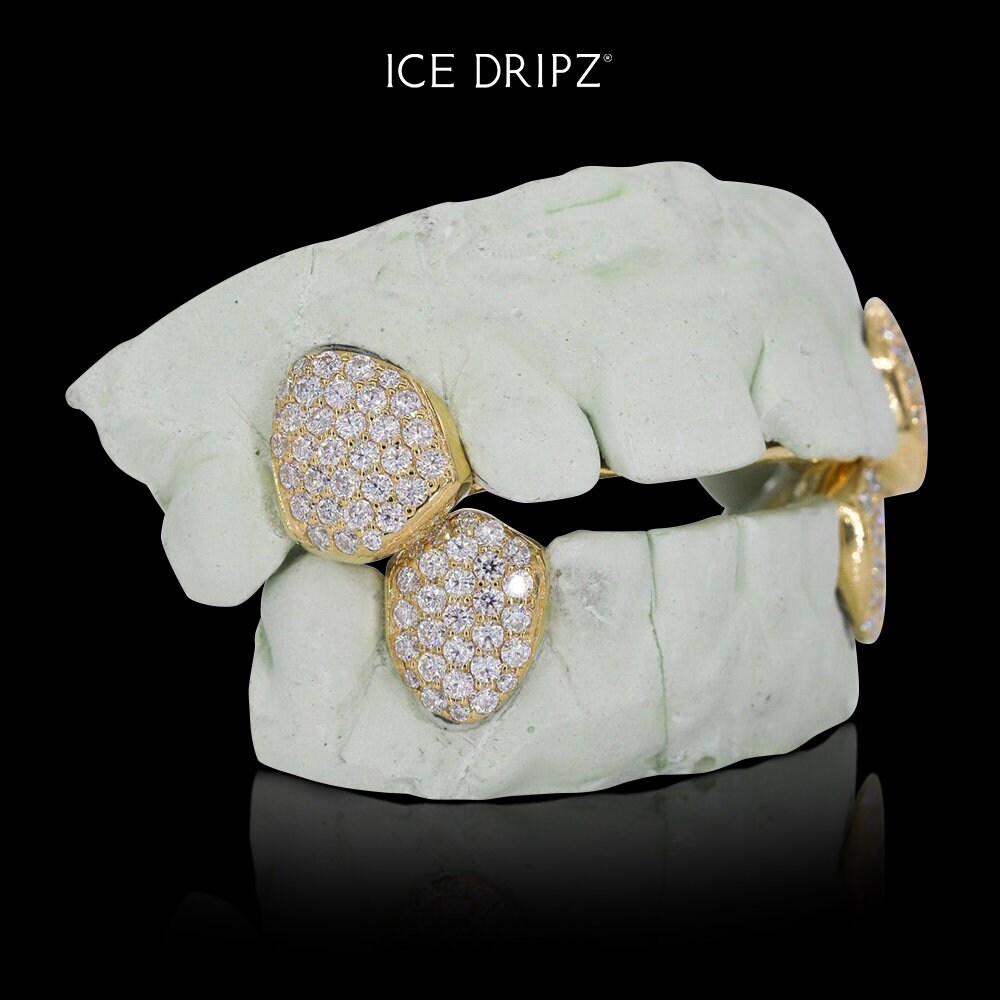 Diamond Fangs VVS Moissanite Diamond Grillz, Hip Hop Jewelry, Iced ...