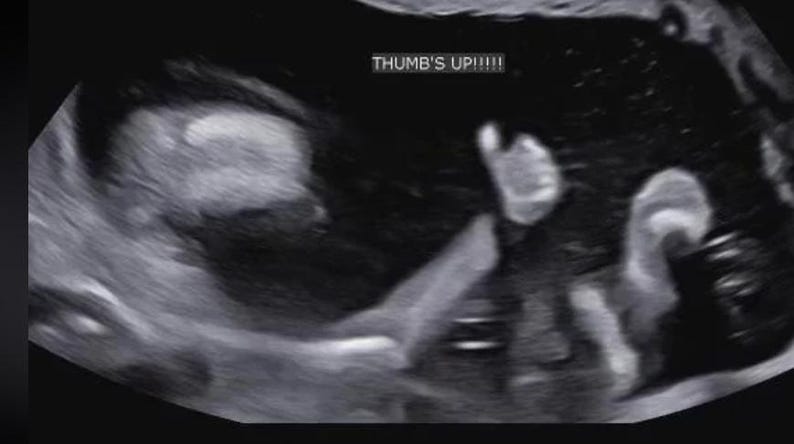 Ultrasound Image Digital Ultrasound Fun Gag Gift for Friends & Family ...