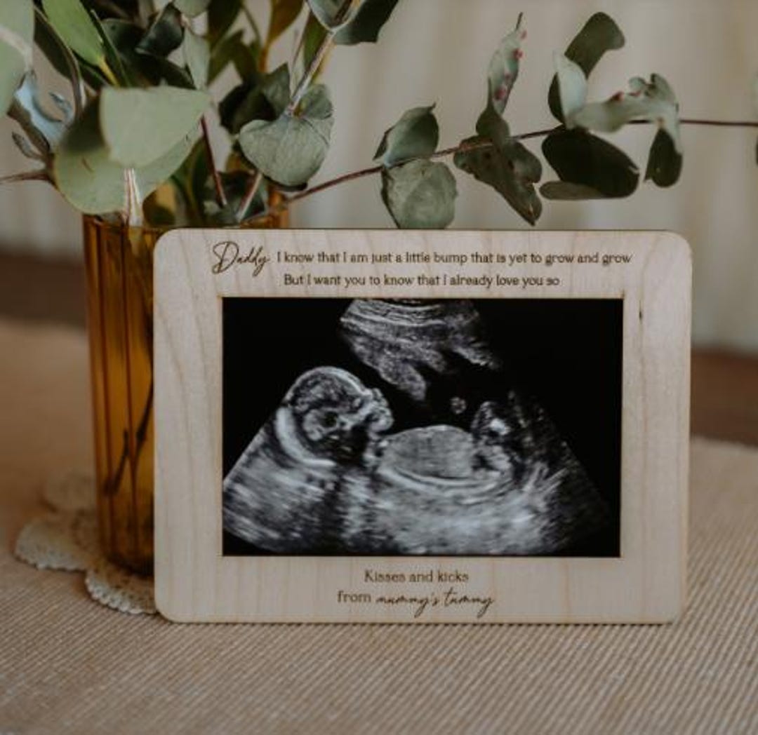 Ultrasound Image Digital Ultrasound Fun Gag Gift for Friends & Family ...
