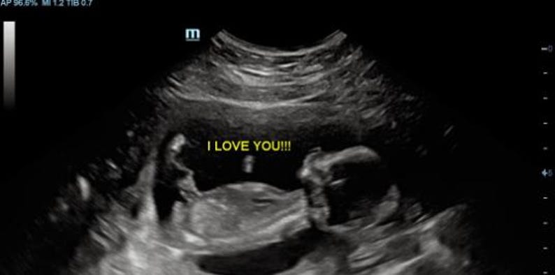 Ultrasound Image Digital Ultrasound Fun Gag Gift for Friends & Family ...