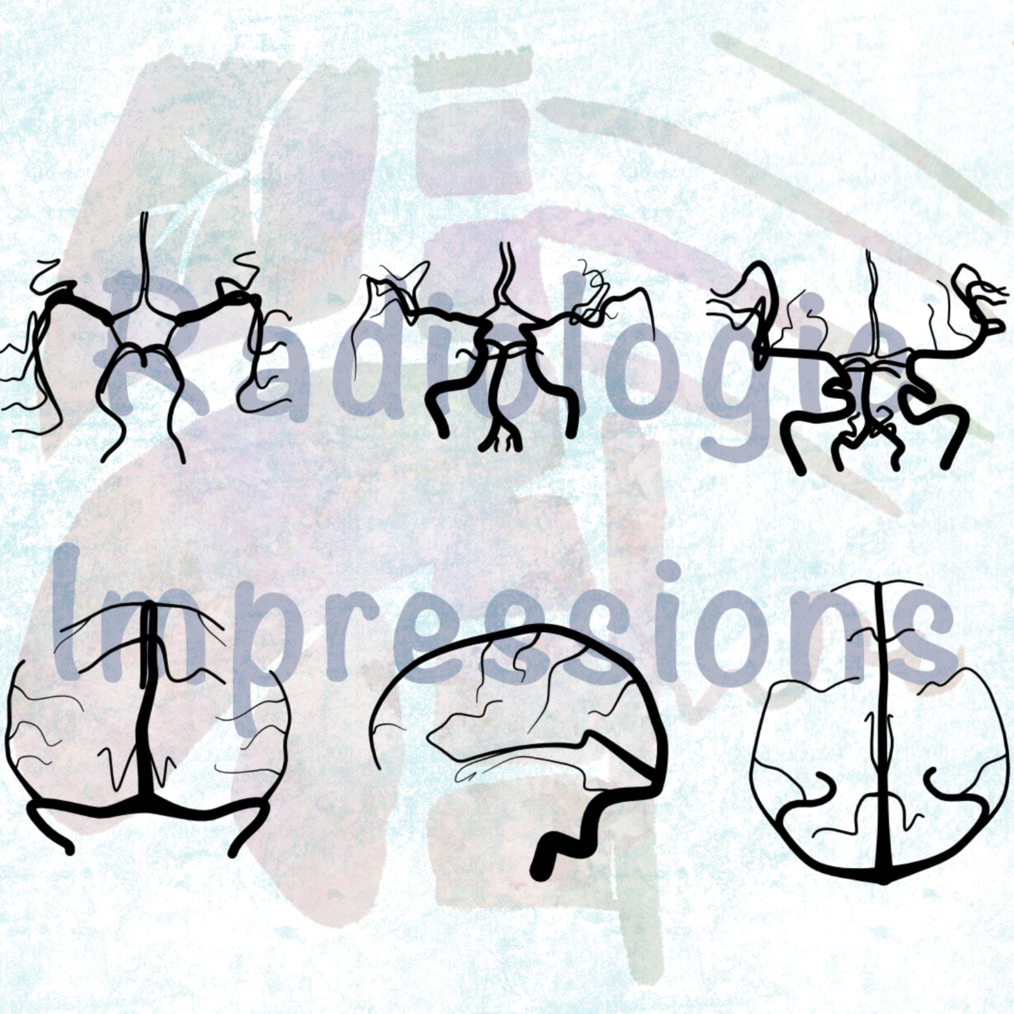 Cerebral Angiogram Arteries and Veins SVG Files for Laser Cricut ...