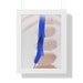 Radiology IR Art Framed Poster of IVC Filter Inferior Vena Cava ...