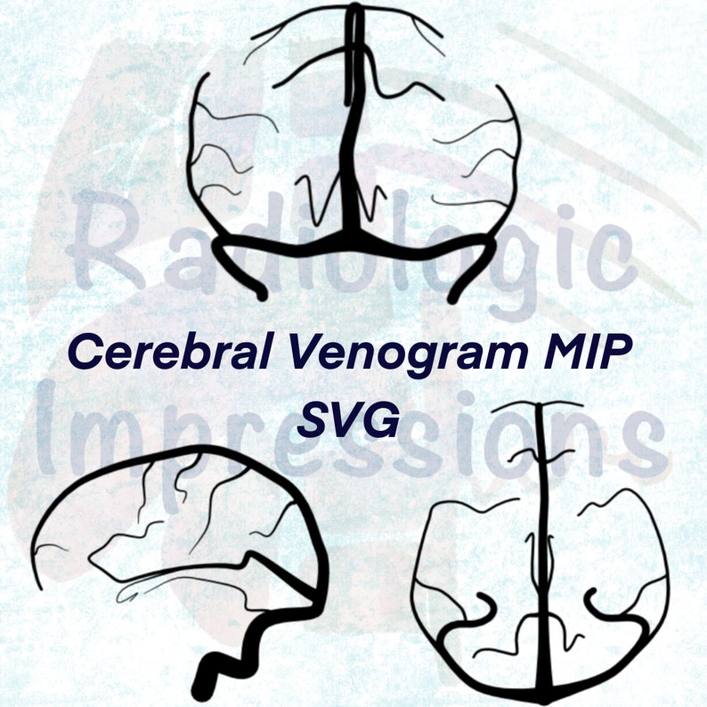 Cerebral Angiogram Arteries and Veins SVG Files for Laser Cricut ...