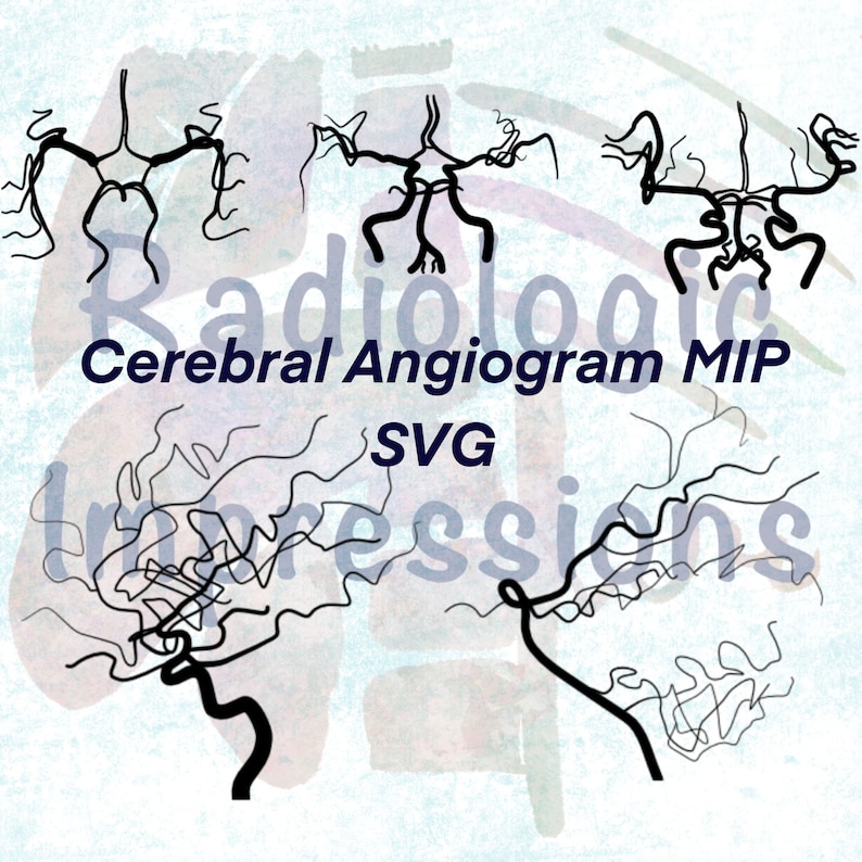 Cerebral Angiogram Arteries and Veins SVG Files for Laser Cricut ...