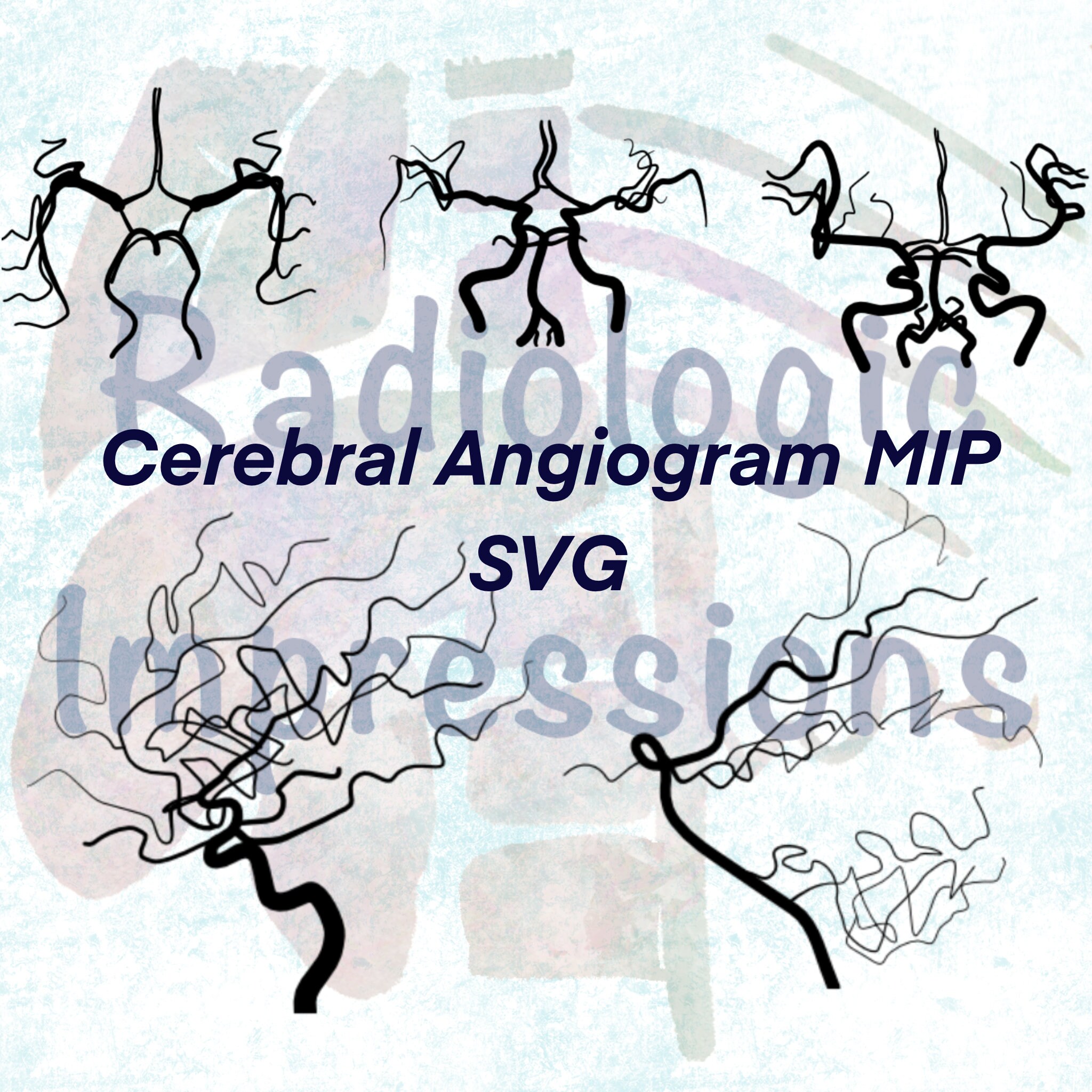 Cerebral Angiogram Arteries and Veins SVG Files for Laser Cricut ...