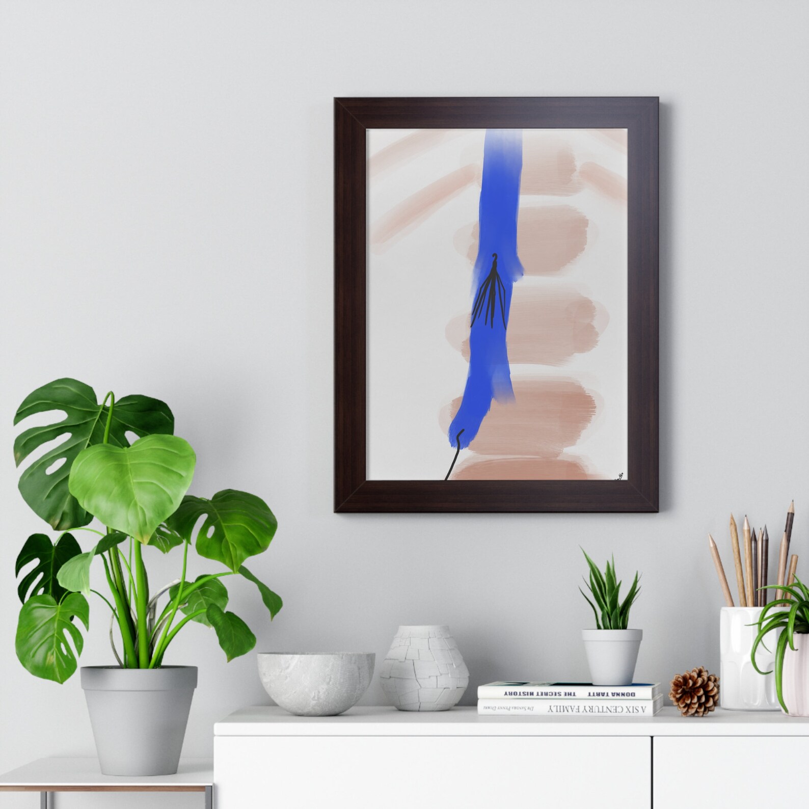Radiology IR Art Framed Poster of IVC Filter Inferior Vena Cava ...