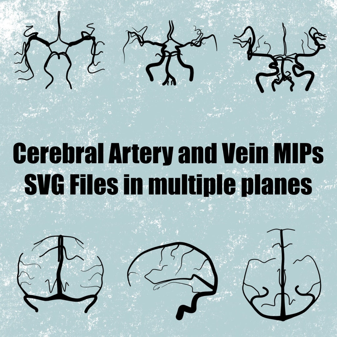 Cerebral Angiogram Arteries and Veins SVG Files for Laser Cricut ...