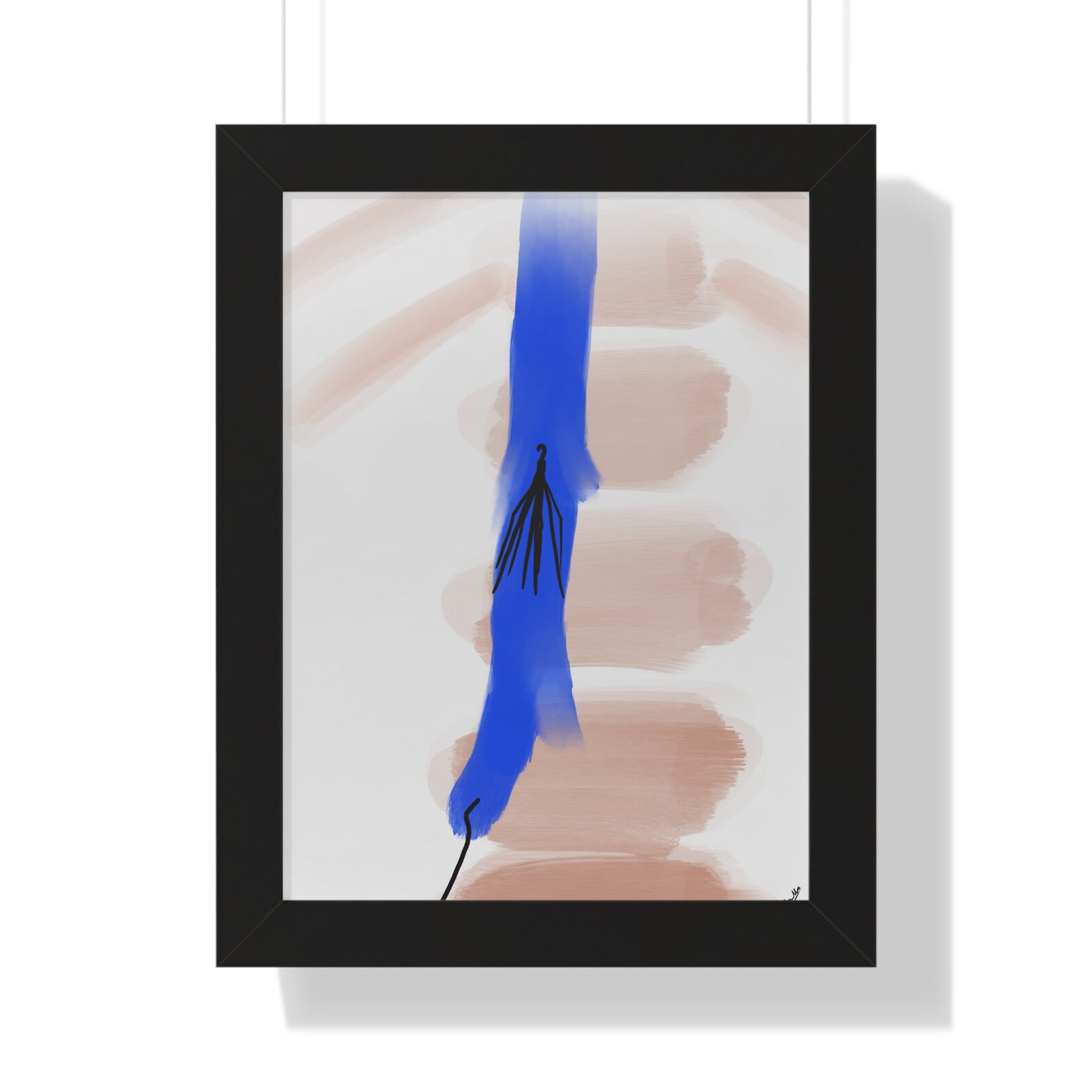 Radiology IR Art Framed Poster of IVC Filter Inferior Vena Cava ...