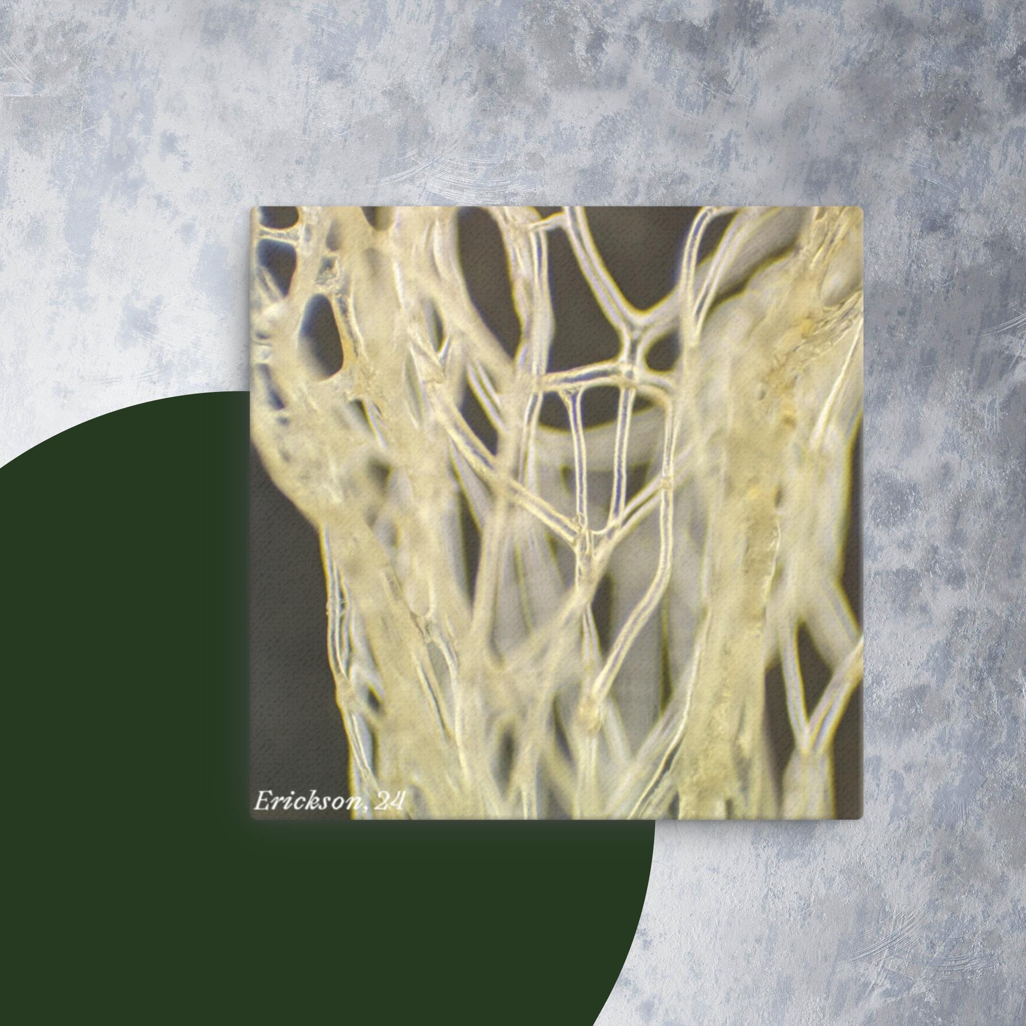 Microscopic Sponge Structure Canvas Wall Art - Etsy