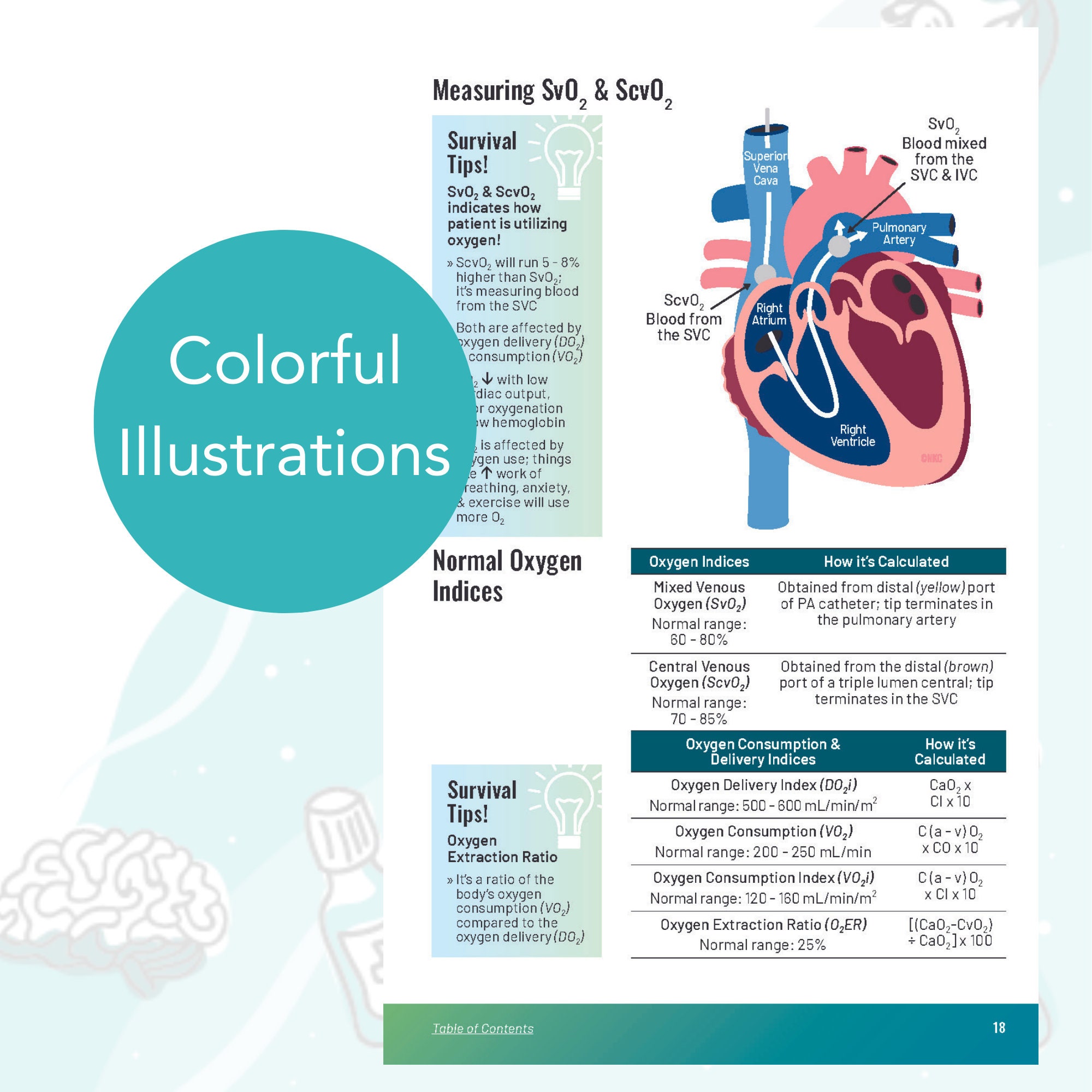 Hemodynamics Critical Care Study Guide | CCRN® Pulmonary Artery ...