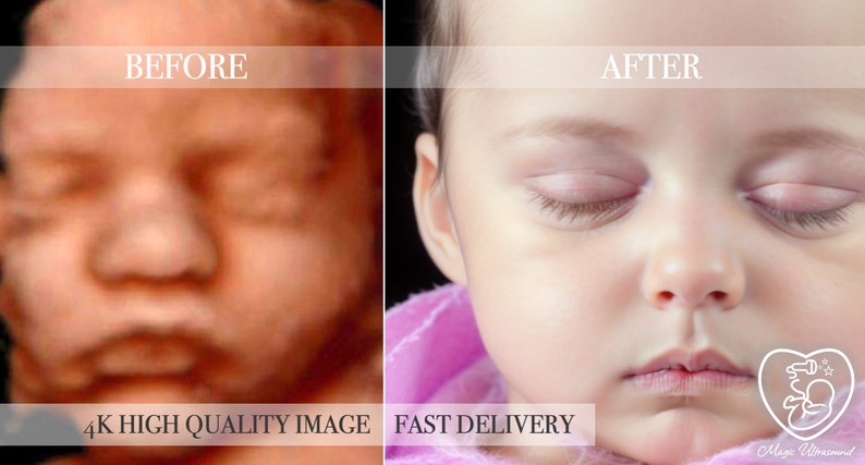 Photorealistic Baby Ultrasound (bonus: Photo Animation) | 8K Real View ...