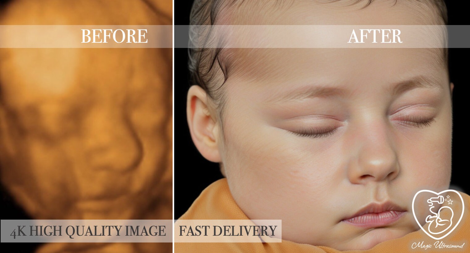 Photorealistic Baby Ultrasound (bonus: Photo Animation) | 8K Real View ...